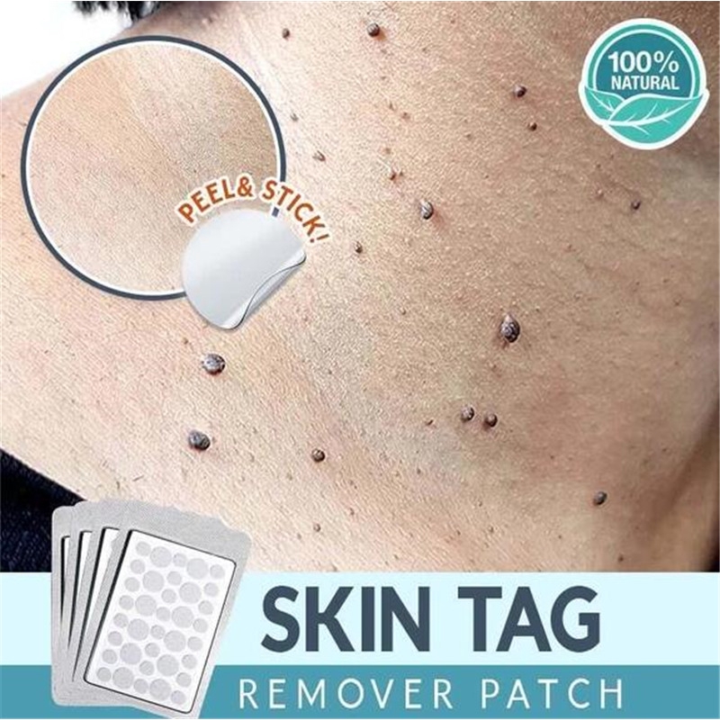 Skin Tag Remover Patch Ance Pimple Patch Plaster Acne Cream ...
