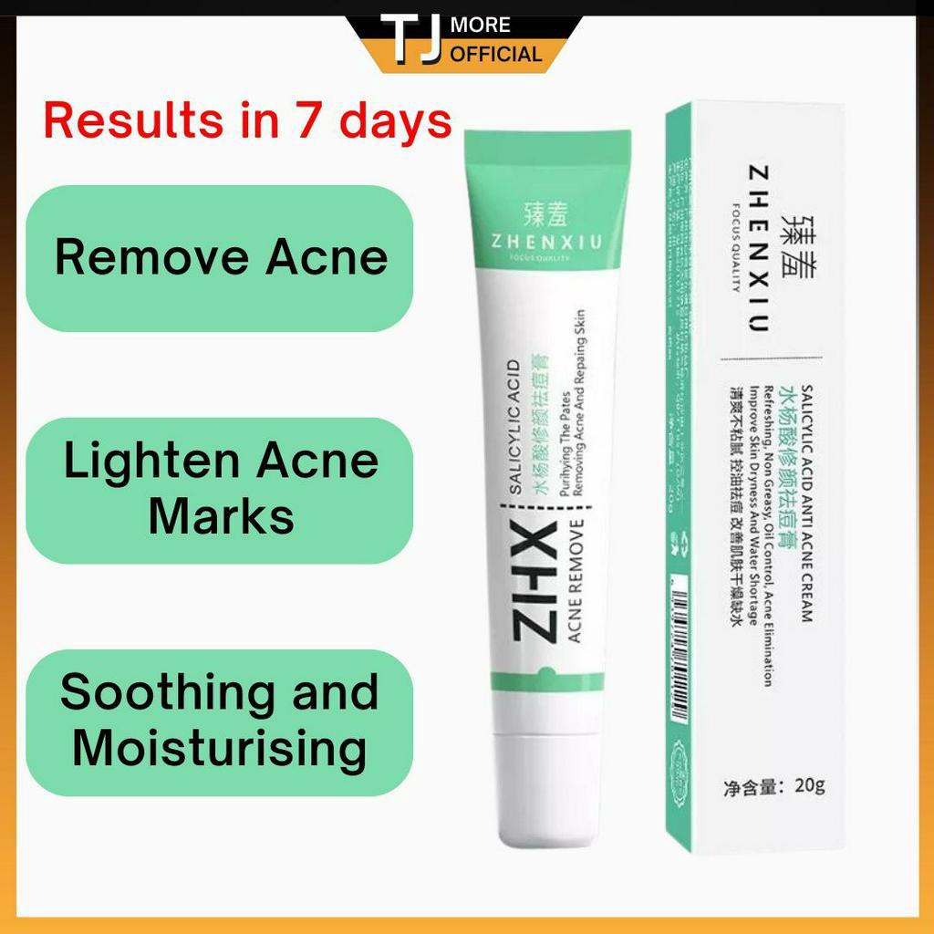 ZHX Anti Acne Cream Salicylic Acid Cystic Acne Treatment Acne Scar ...