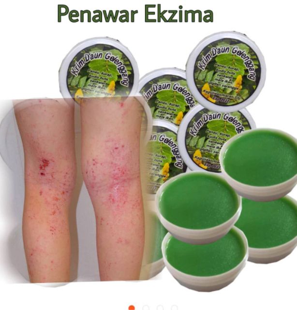 Ubat Traditional Krim daun Gelenggang 100% asli. Badan gatal2 Panau ...