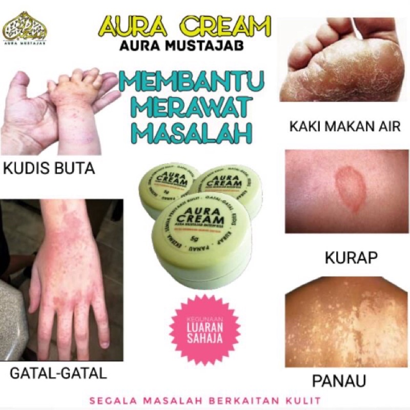 AURA CREAM AURA MUSTAJAB - RAWAT KURAP, KUDIS, GATAL2, PANAU, EKZEMA ...