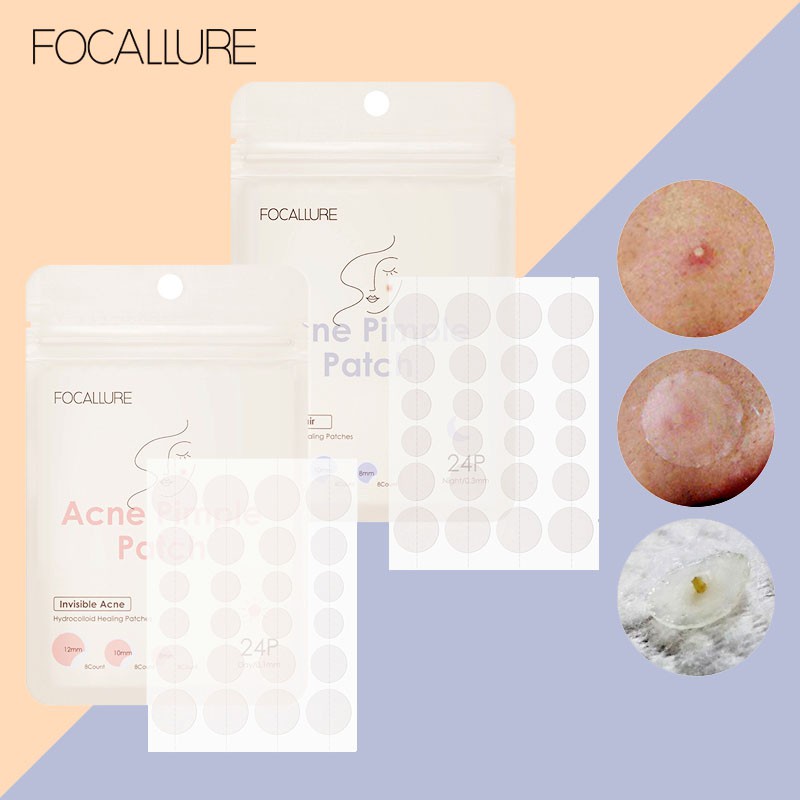 Focallure Waterproof Acne Patch Blemish Treatment Skin Care Acne Repair ...