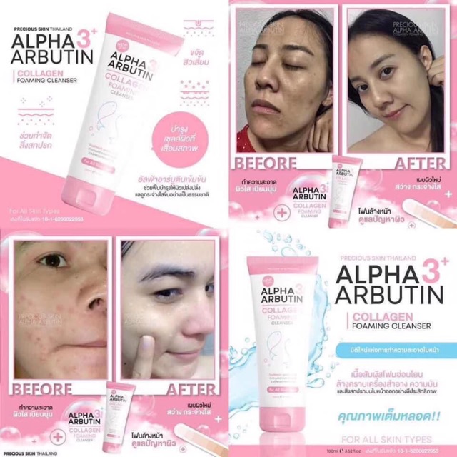 ALPHA ARBUTIN 3+ COLLAGEN FOAMING CLEANSER 120ml- Precious Skin thailand | Shopee Malaysia