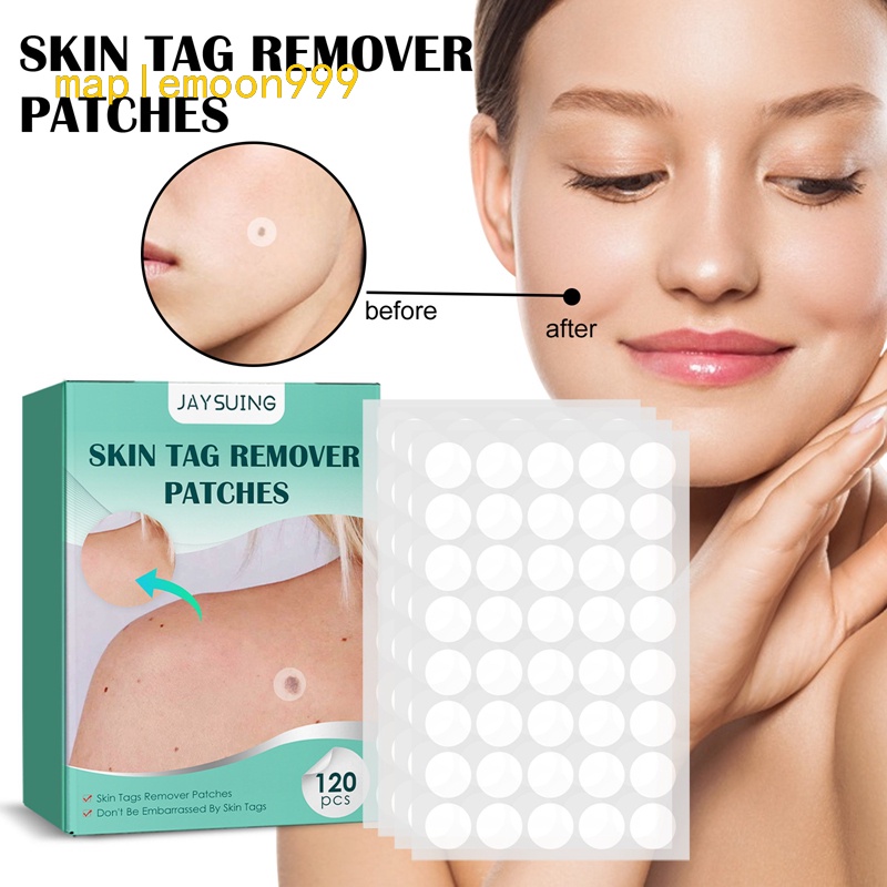 Warts Remover Patch Skin Tags Pimple Treatments Cream Hydrocolloid Gel ...