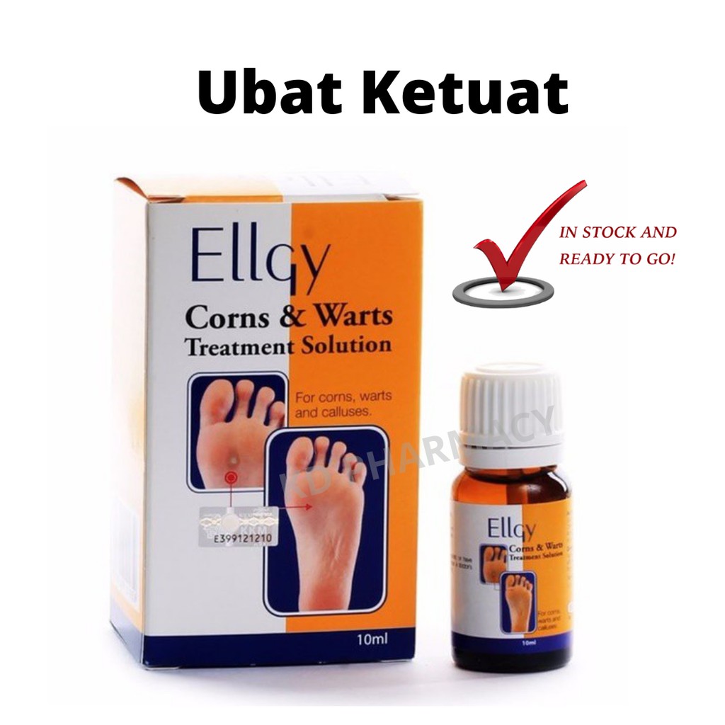 Ellgy Corn and Wart Treatment Solution / Ubat Ketuat | Shopee Malaysia