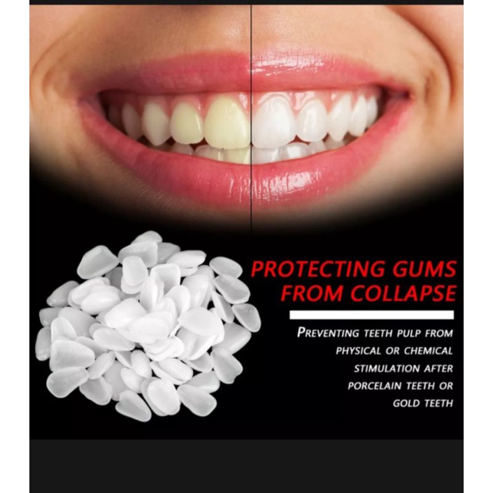 Readystock 50pcs yellow Dental Ultra Thin Veneers Teeth | Shopee Malaysia