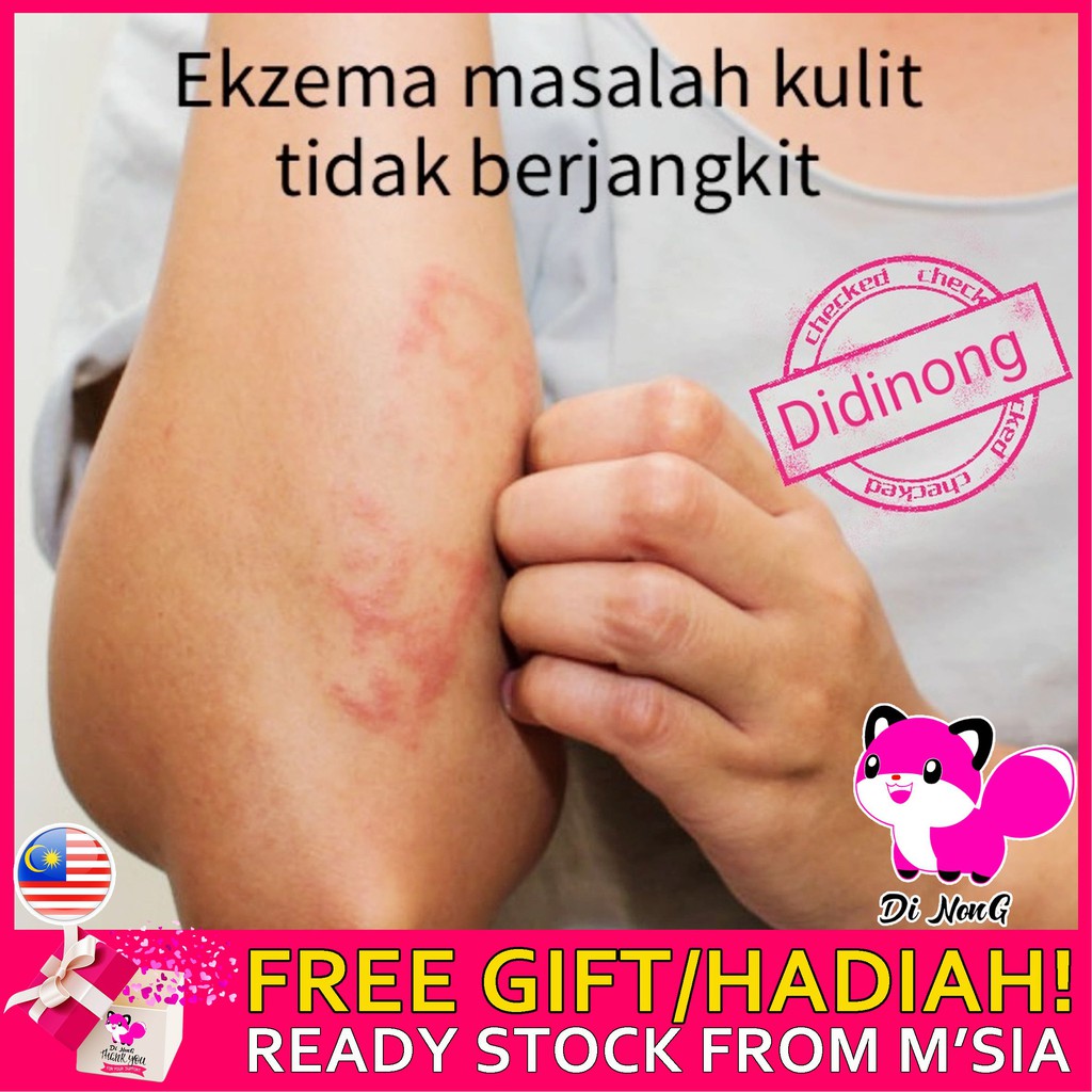 Gatal Kudis (Scabies) Sabun Ekzema masalah kulit Gatal Ekzema tidak ...