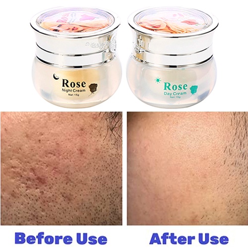 Feique Rose Extract Purifying Nutrition Anti-Freckle Cream Anti-Wrinkle ...