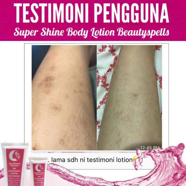 Parut kudis & kulit sensitif sume settled !! | Shopee Malaysia