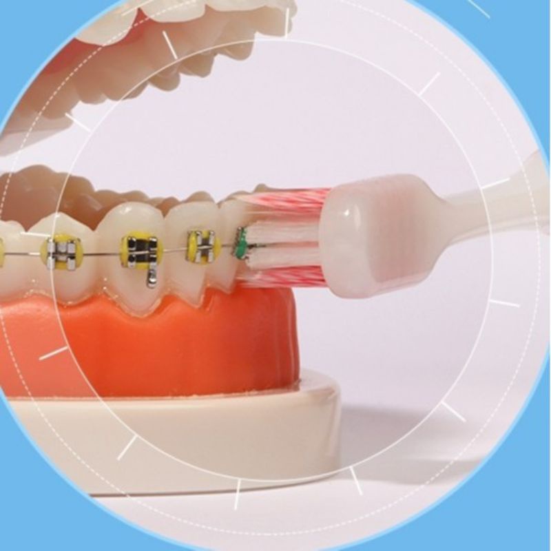 Ortho orthodontic Braces Brackets bracket Toothbrush 绑牙牙刷 Berus gigi ...