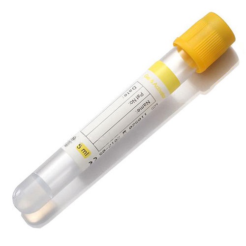5mL Yellow blood vacuum Tubes Plastic /SST | Shopee Malaysia