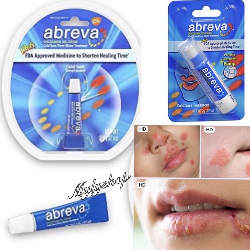 Abreva mouth herpes cream 2g | Shopee Malaysia