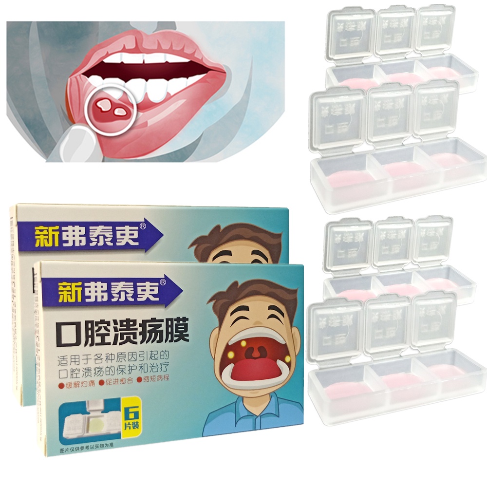Ifory Oral Ulcers Patch 12pcs/2boxes Relief Severe Pain Irritation ...