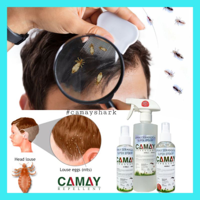 Hot Selling Ubat Kutu Kepala Natural Head Lice Camay Repellent