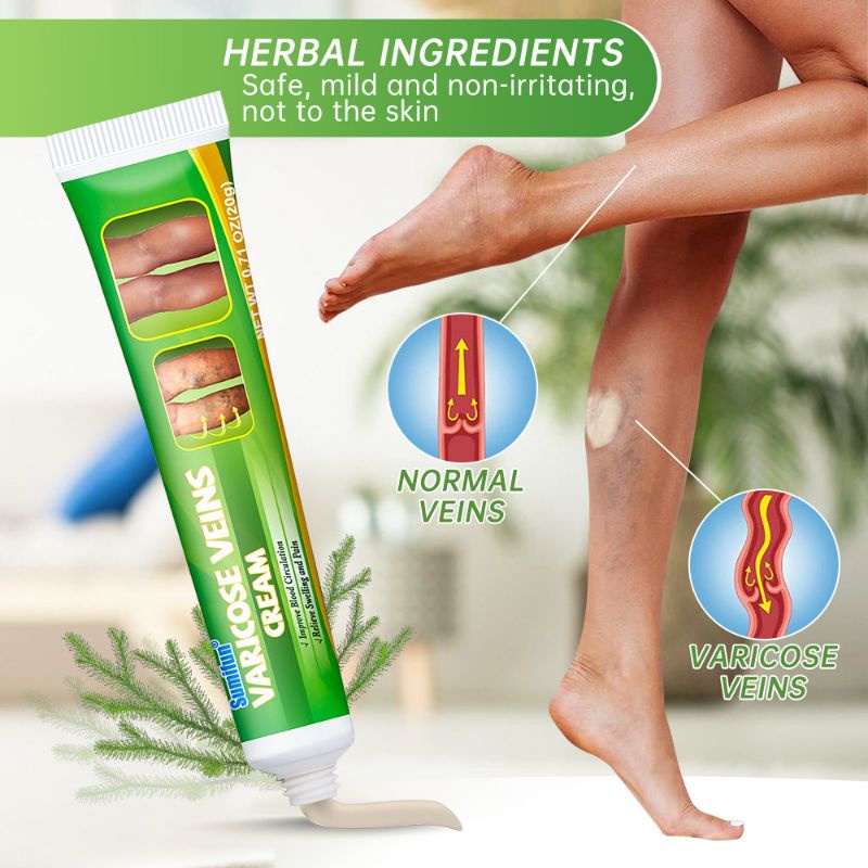 Varicose Vein Cream For Spider Veins & Varicose Veins Removal Leg Care ...