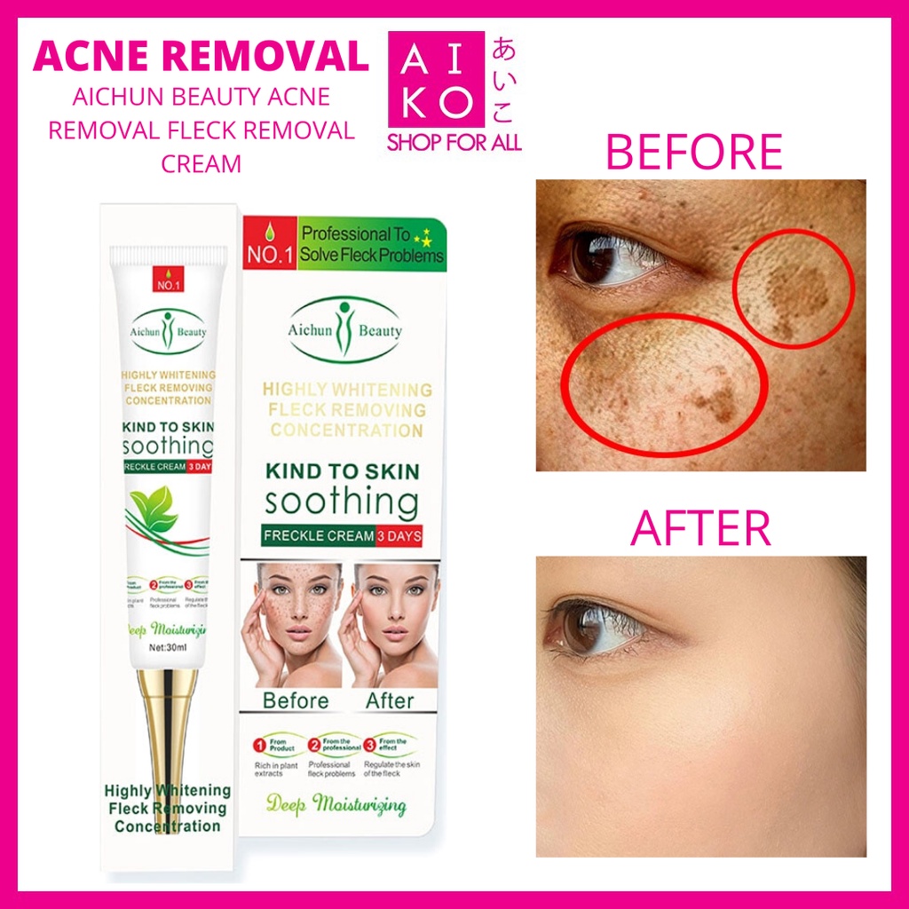 (AIKO)AICHUN BEAUTY ACNE REMOVAL FLECK REMOVAL CREAM | Shopee Malaysia