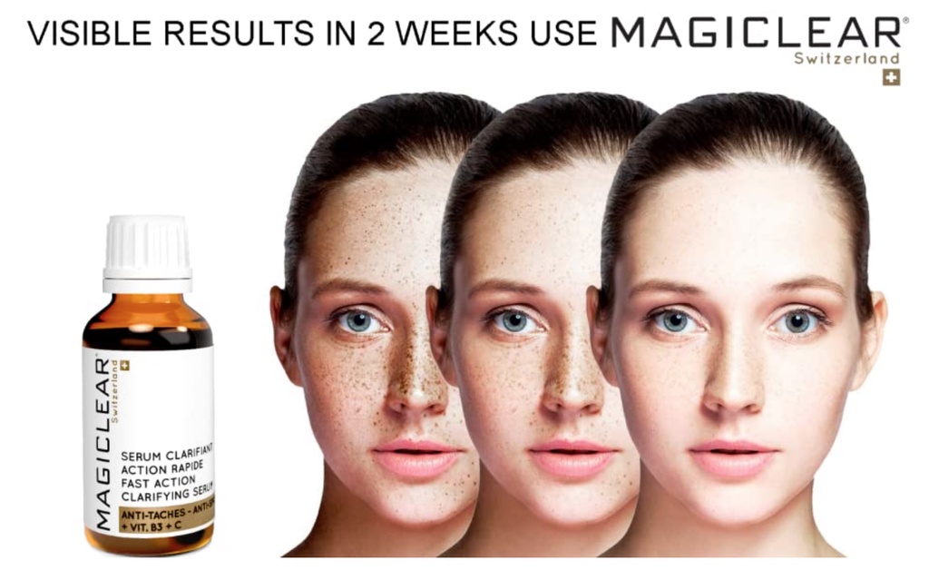 Magiclear Set of 4' (Cleanser + Gel Tube + Cream Tube + Serum) | Shopee ...
