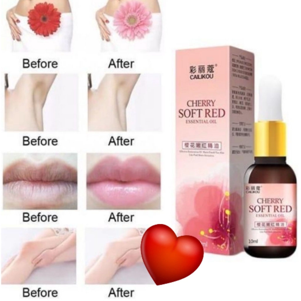 Pink Puteng/ Pinkish Whitening Body Skin Glowing/ Darkspot/ Anti Dark ...