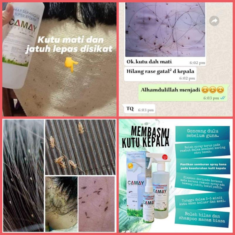 💥READY STOK💥Spray kutu kepala berkesan/kutu haiwan, lice spray, camay ...