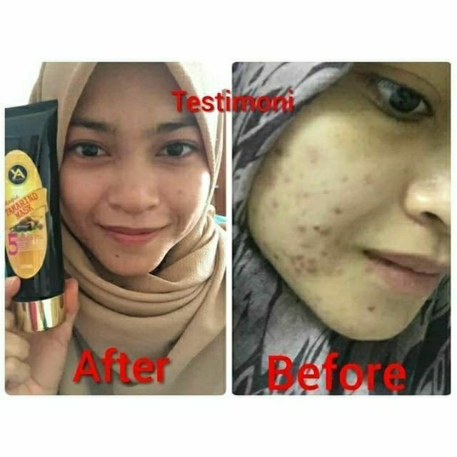Magic Tamarind Mask Masker Kuatkan Skin Barrier | Shopee Malaysia