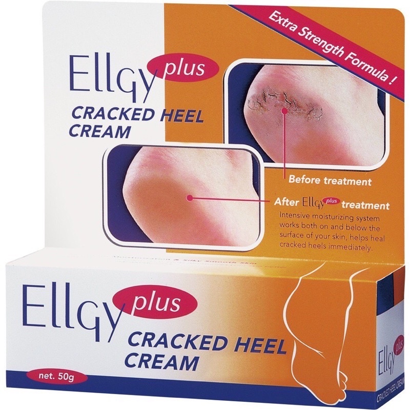 Ellgy Plus Cracked Heel Cream 50g | Shopee Malaysia