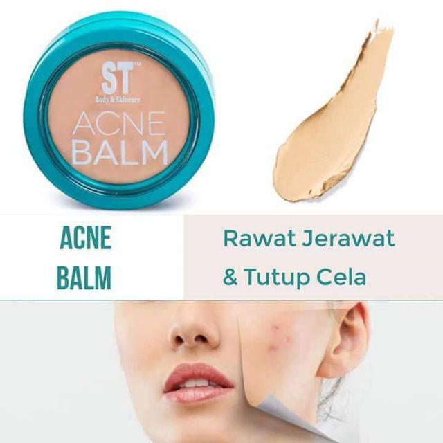 ACNE SERIES SET by SENDAYU TINGGI | Shopee Malaysia