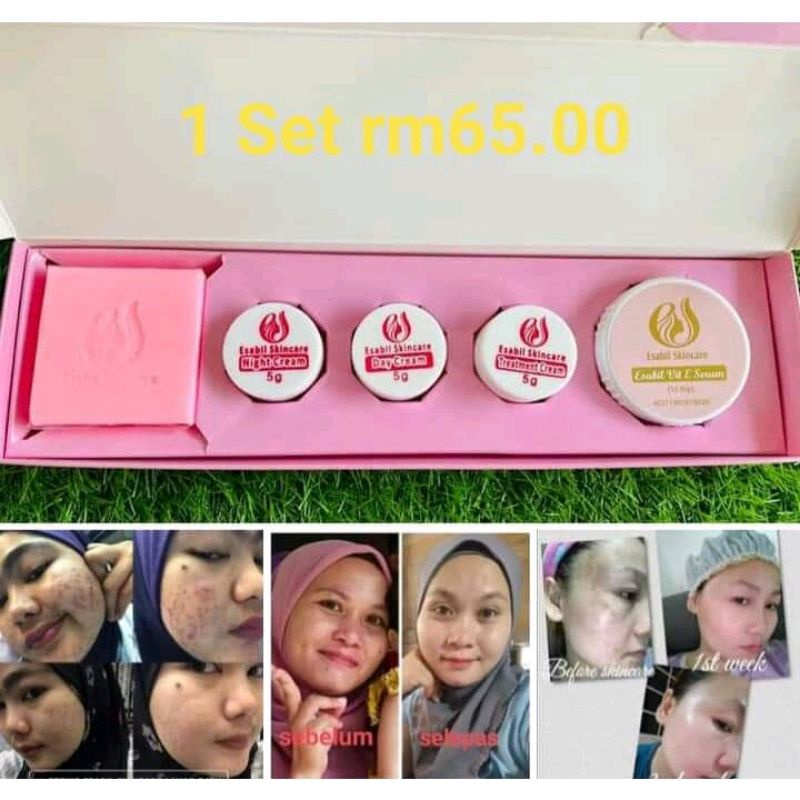 ESABIL SKINCARE 6 IN 1 ESABIL BEAUTY | Shopee Malaysia