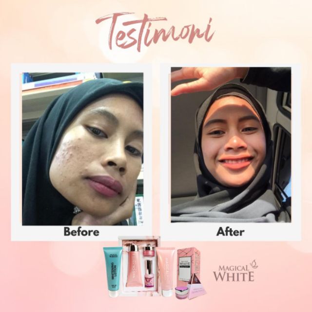 🔥🔥 MAGICAL WHITE HQ🔥🔥 | Shopee Malaysia