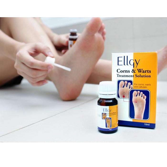 Ellgy Corn & Warts Treatment Solution 10ml | Shopee Malaysia