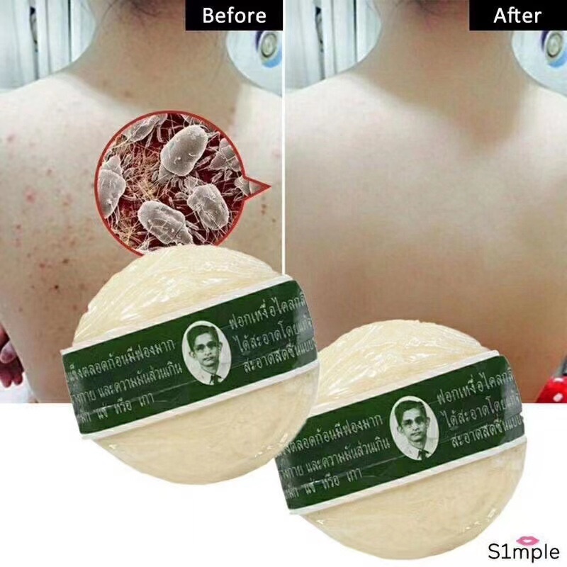 Rawra Herbal Distilled Soap[kulit gatal/ekzema] 泰国阿公肥皂 170G Original ...