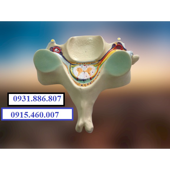 Models Of Spinal Surgery And Horizontal Cross-Cut Vertebrae | Shopee ...
