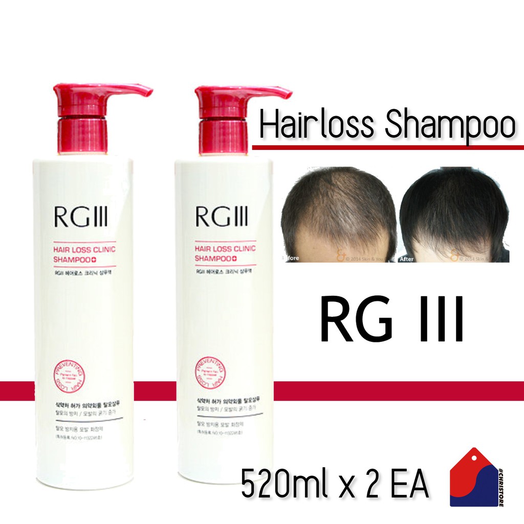 [1+1 COMBO] RG3 Hair Loss Clinic Shampoo Korean Red Ginseng 520ml x 2EA ...