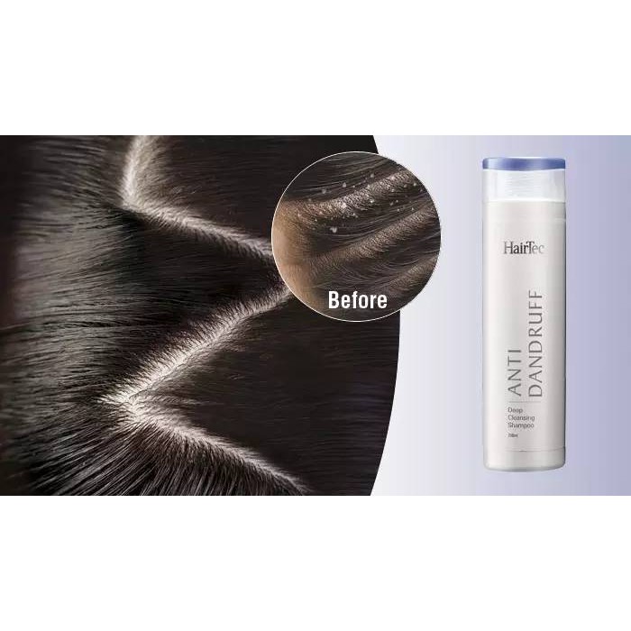 Cosway HairTec Anti-Dandruff Shampoo (250ml) | Shopee Malaysia