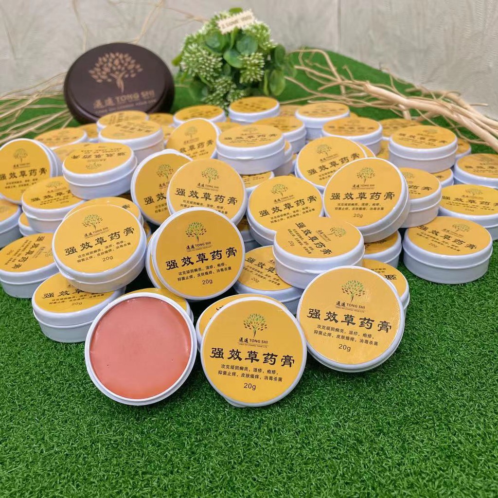 TONG SHI 草药癣膏Nurture Herbal Special Ointment Cream 20g KRIM PSORIASIS ...