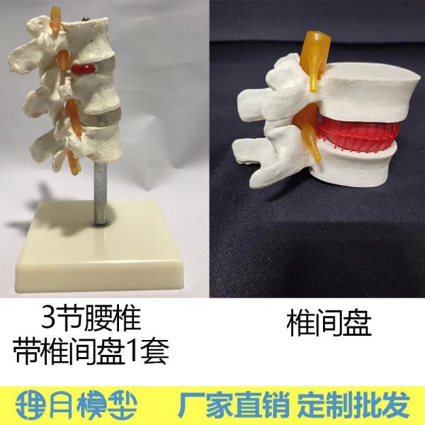 Human Spine Lumbar Intervertebral Disc Protrusion Model Magnification ...