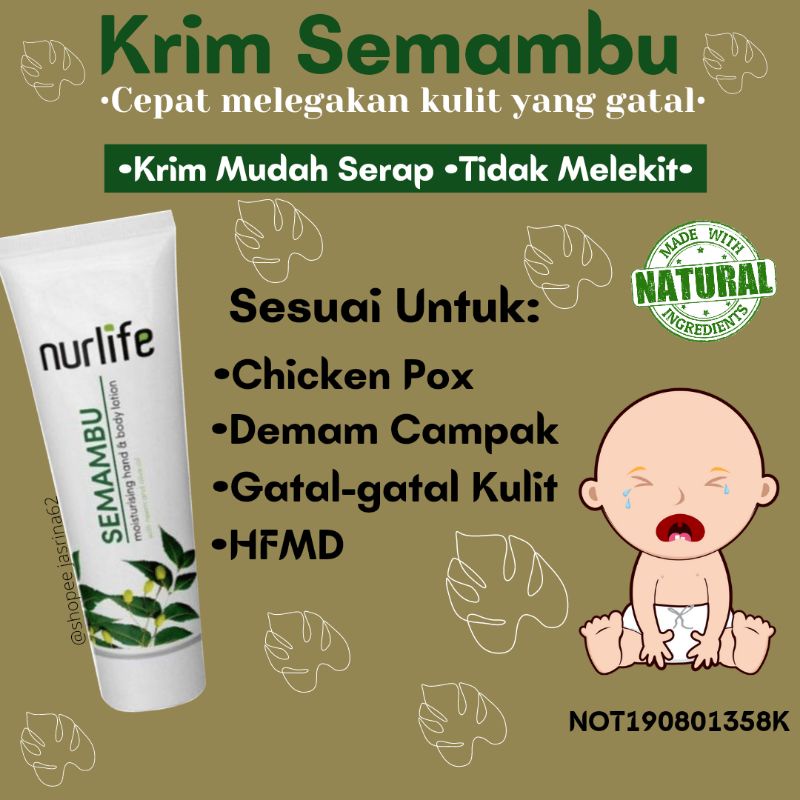 🔥SHIP TODAY🔥Lotion Krim Semambu Untuk Demam Campak Gatal Ruam Kulit ...