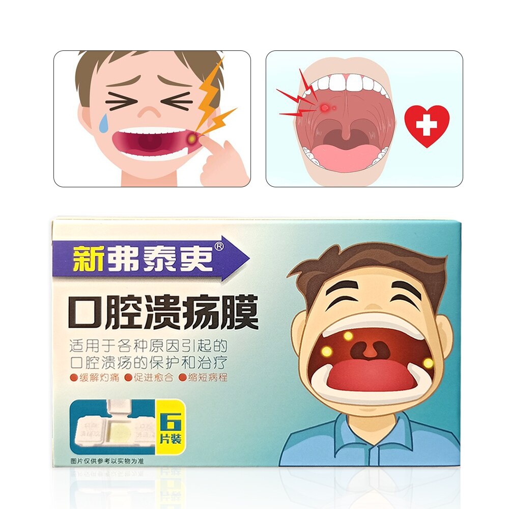 Ifory Mouth Ulcer Patch Antibacterial Spray Film 6Pcs/Box Relief Severe ...