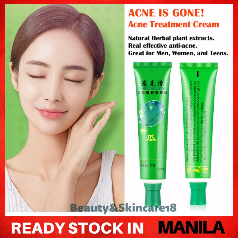 Effective Acne Treatment Cream Anti-Acne Marks Acne Scars Desalting Pimple Repair | Shopee Malaysia