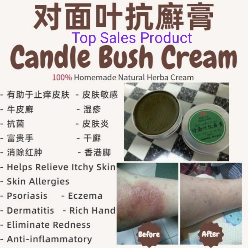 对面叶抗癣膏 / Candle Bush Cream / Kurap Panau / Krim Daun Gelenggang ...