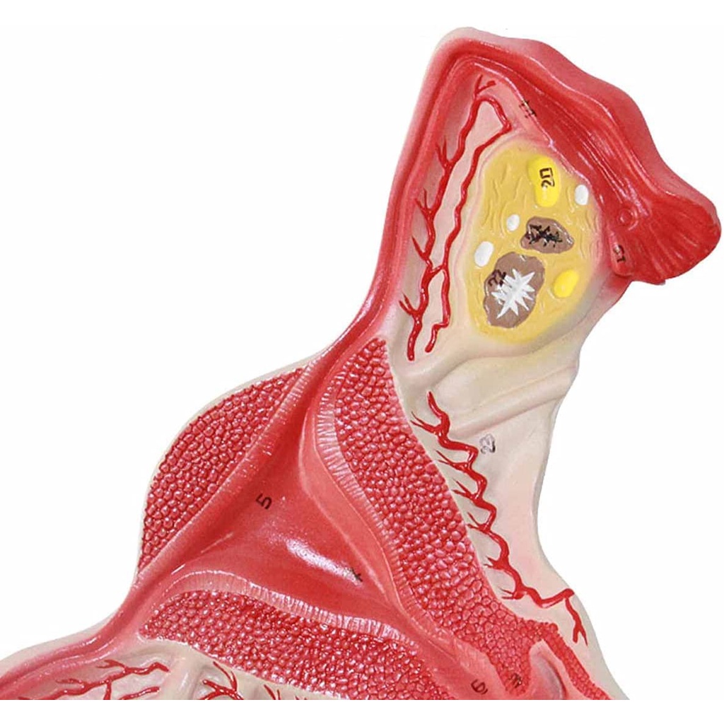 Human Uterus Ovary Female Reproductive Organ Model Medical Teaching ...
