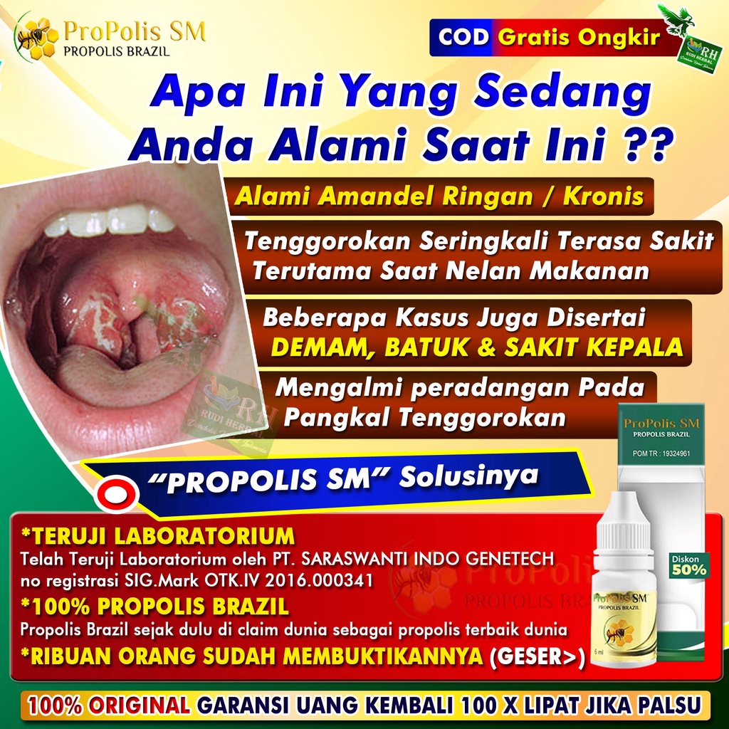 PUTIH Tonsil Medicine For Children & Adults Propolis SM 100% Original Original - Acute & Chronic ...