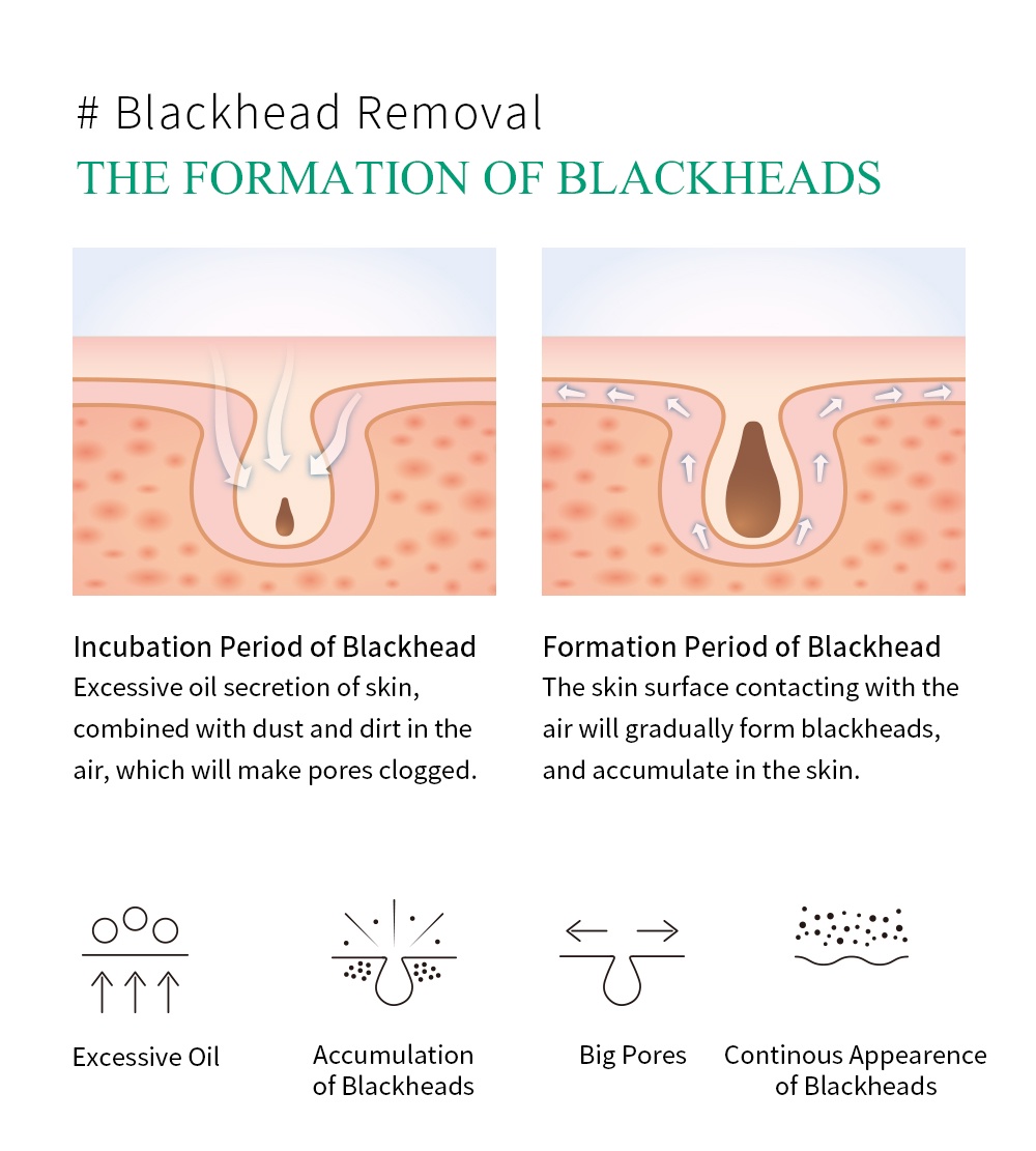 BREYLEE Blackhead Removal Nose Strips Skincare Peeling Off Nose Mask ...