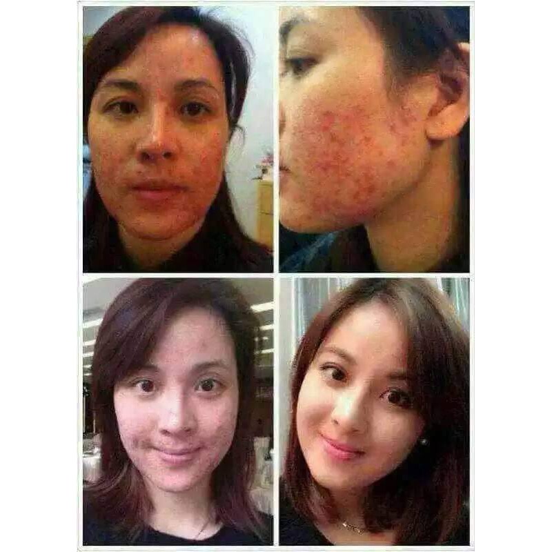 Maione Skincare Spray Set | Shopee Malaysia