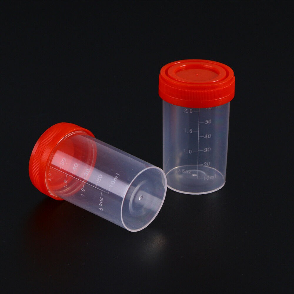 Universal Urine / Sample Container [ per PC ] | Shopee Malaysia