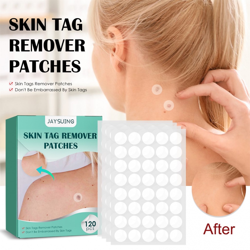 120 PCs/box warts remover patch safe painless skin tags treatment wart ...