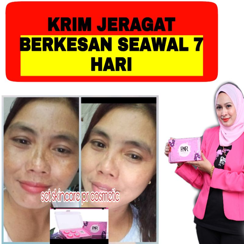 RECOMMENDED PRODUCT👍💯🎉💥SKINCARE PR COSMETIC ( kkm product NOT ...