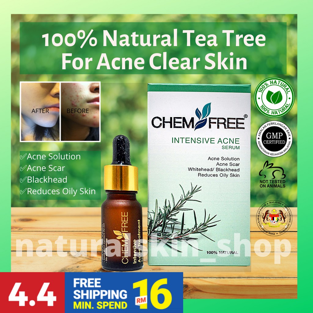 💥Hot Item💥 Chemifree Anti Acne Serum Essence Pimple Serum Intensive ...