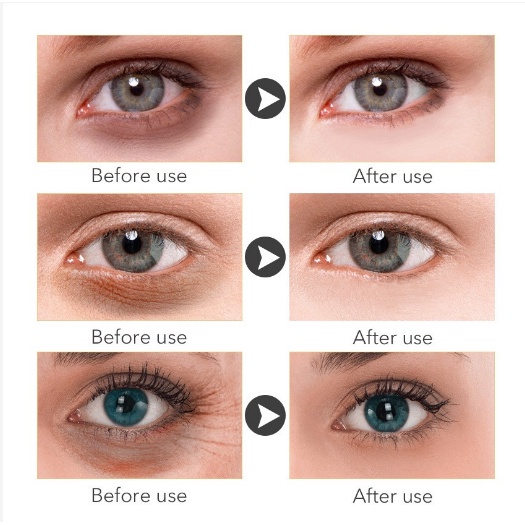 Eye Cream Eye Bag Removal Cream Eye Cream For Dark Circle Fatigue Eye ...