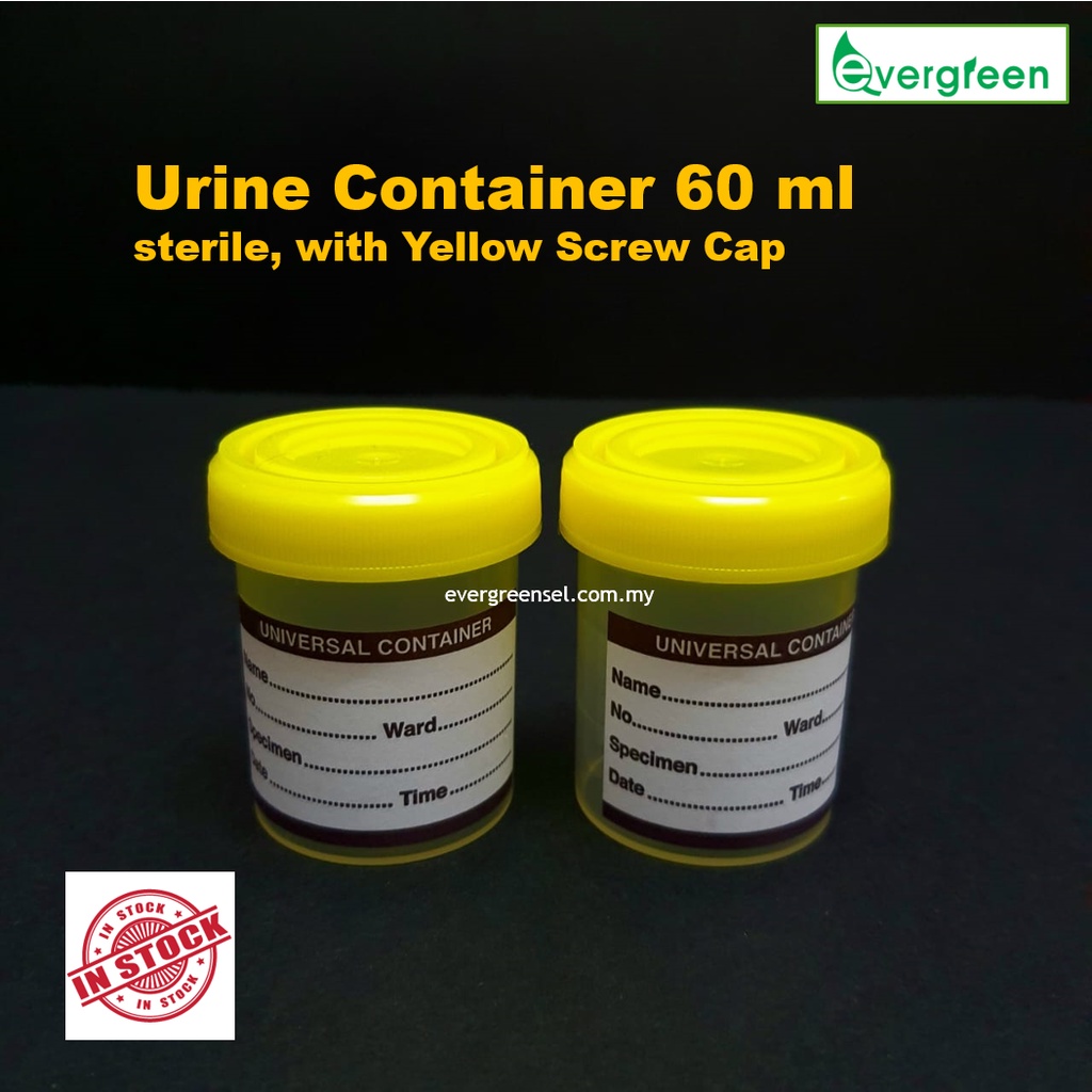 Specimen Container (Urine Container / Universal Container ) 60 ml ...