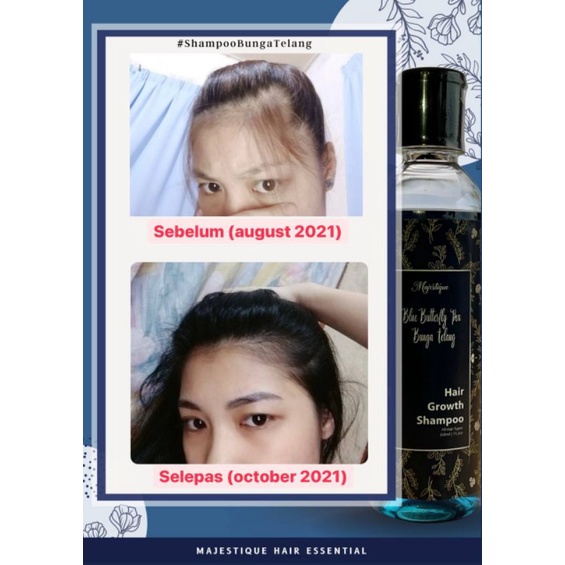 Shampoo Bunga Telang (Expired due 15.02.2025) | Shopee Malaysia