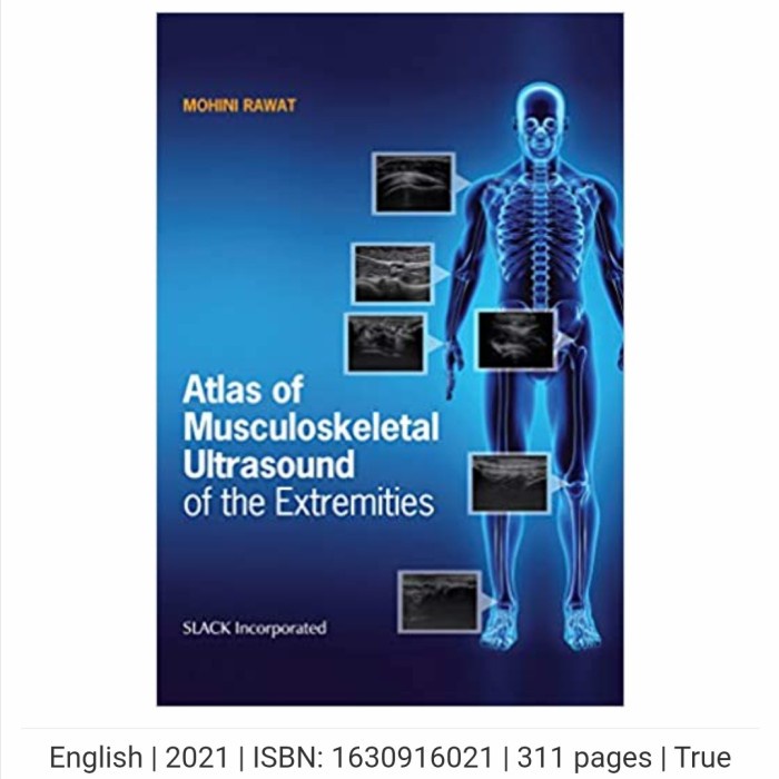 Book Atlas of Musculoskeletal Ultrasound of the Extremities | Shopee ...